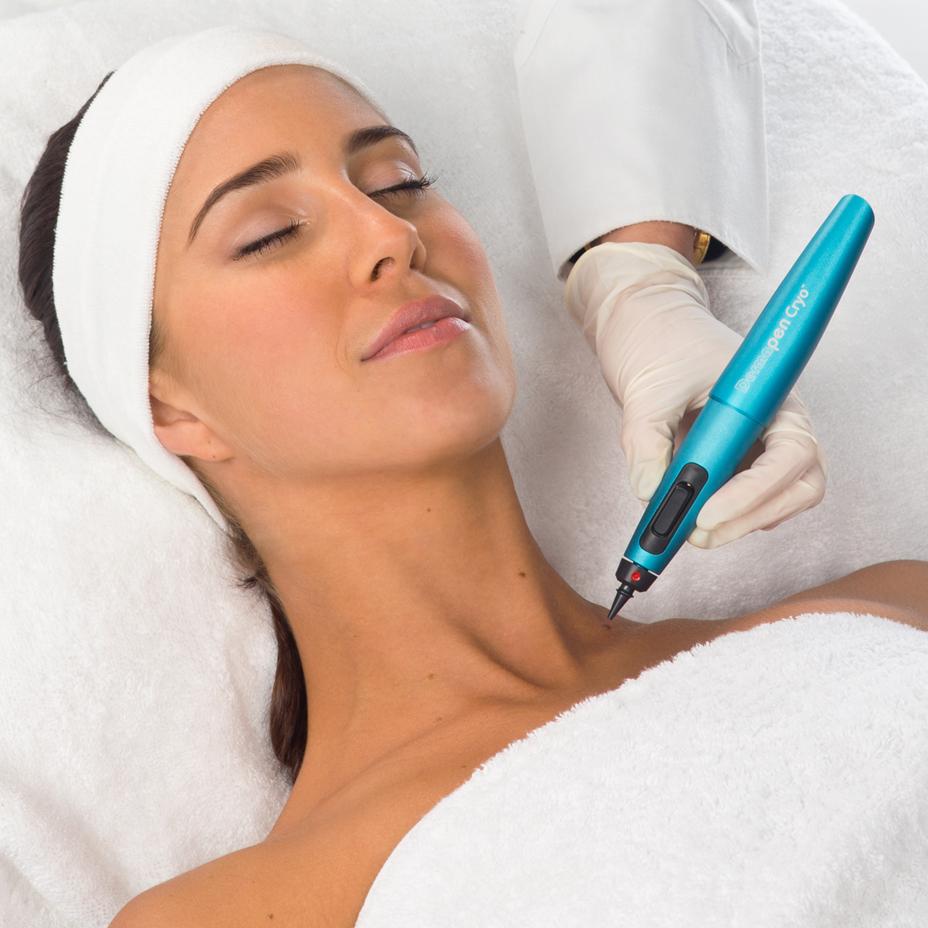 Dermapen Cryo | Hoitola Kuulas